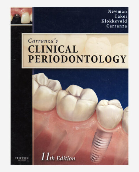 Carranza’s Clinical Periodontology 11th Edition | Library - Lyceum ...