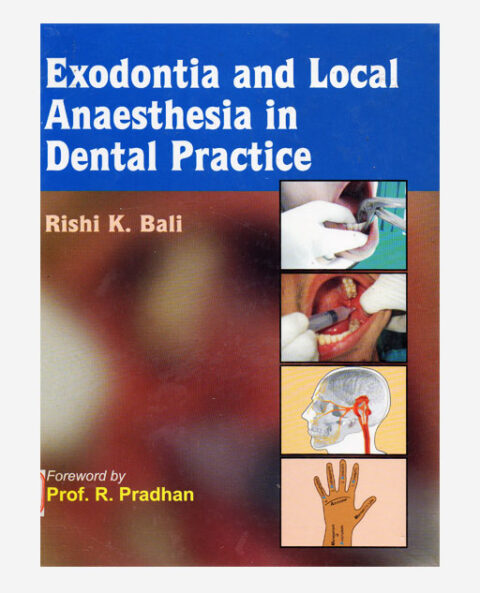 Exodontia and Local Anaesthesia in Dental Practice | Library - Lyceum ...