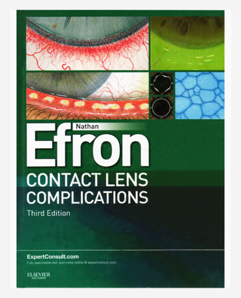 Contact Lens Complications 3rd Edition | Library - Lyceum-Northwestern ...