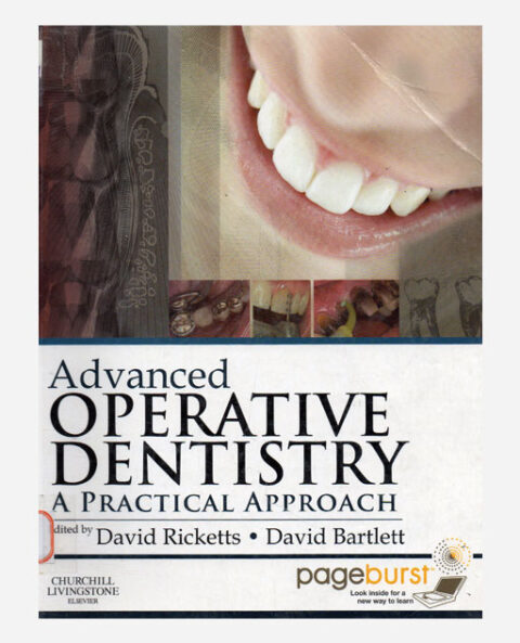 Advance Operative Dentistry a Practical Approach | Library - Lyceum ...